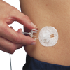 TruSteel Infusion Set | CDE Online